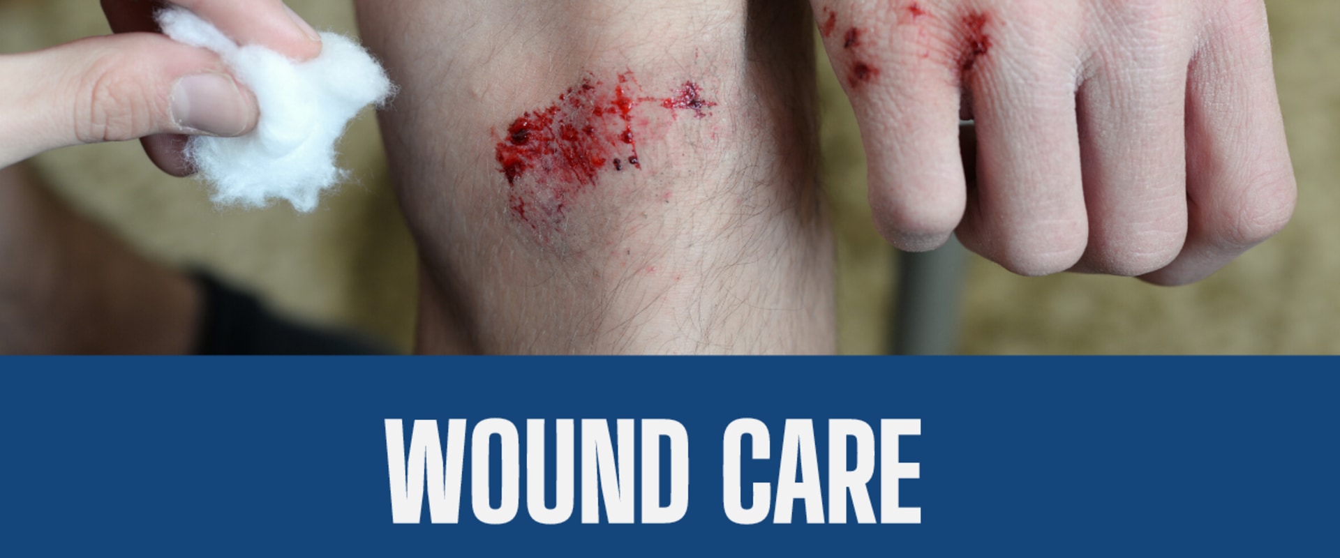 Understanding Wound Care: What Is Purulent Drainage and Discharge for ...
